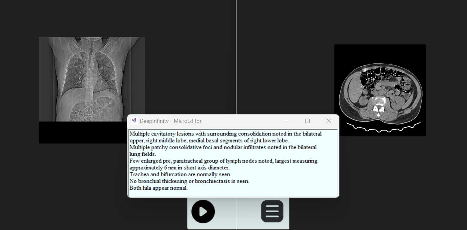 Download and Install DeepInfinity App – deepinfinity